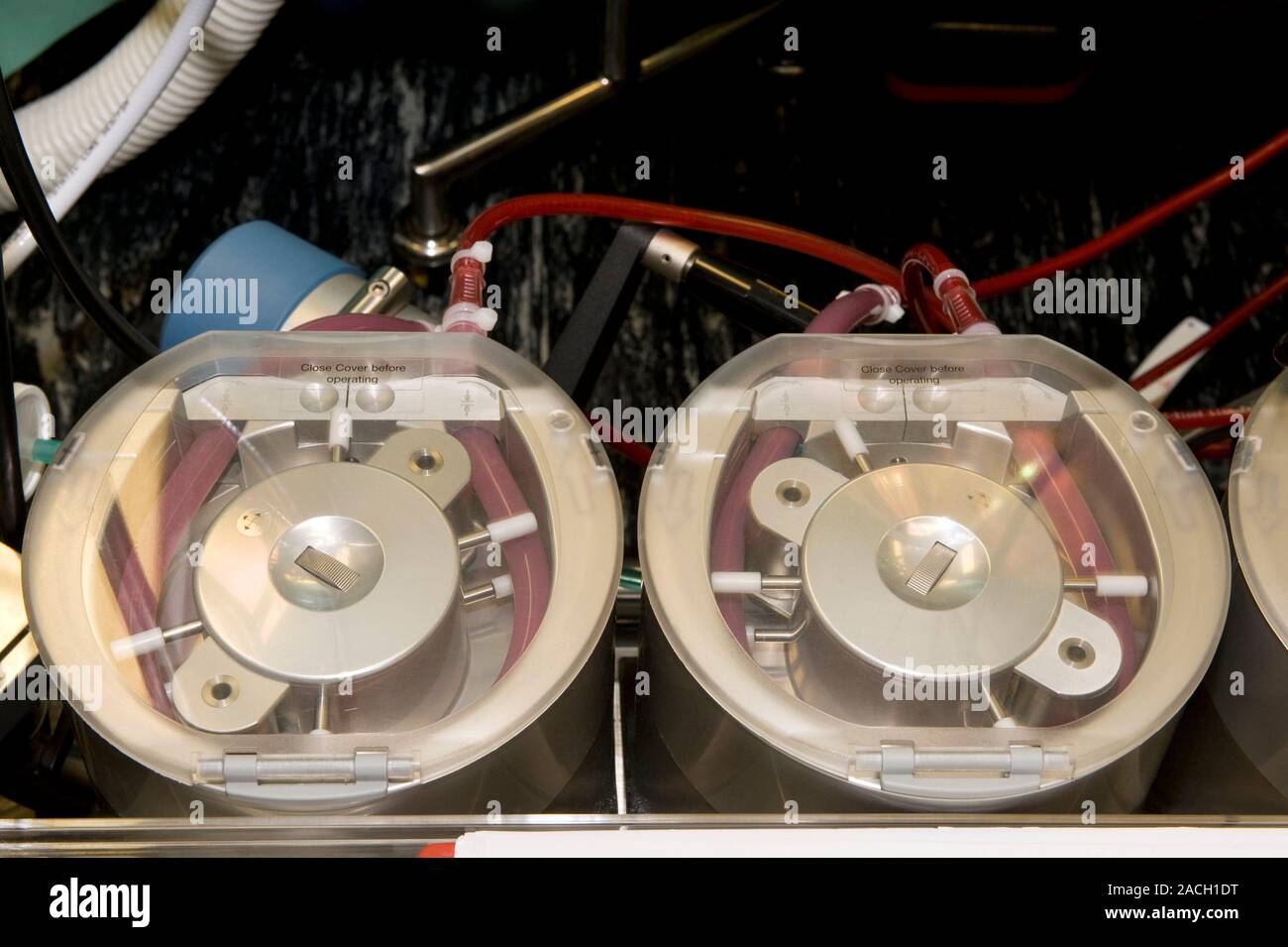 Heart-lung machine in use during heart surgery. A heart-lung machine ...
