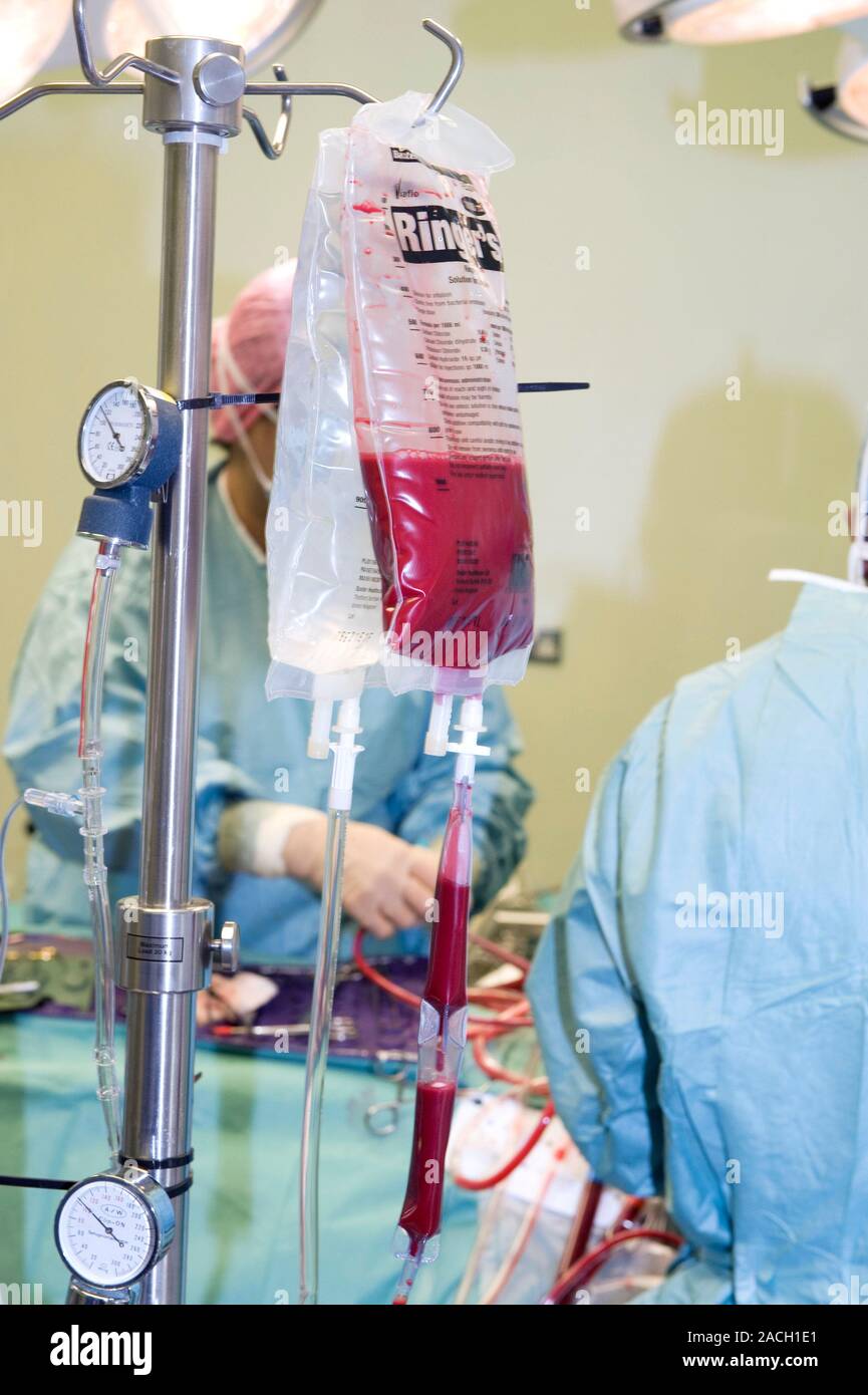 Intravenous drips for use during heart surgery Stock Photo - Alamy