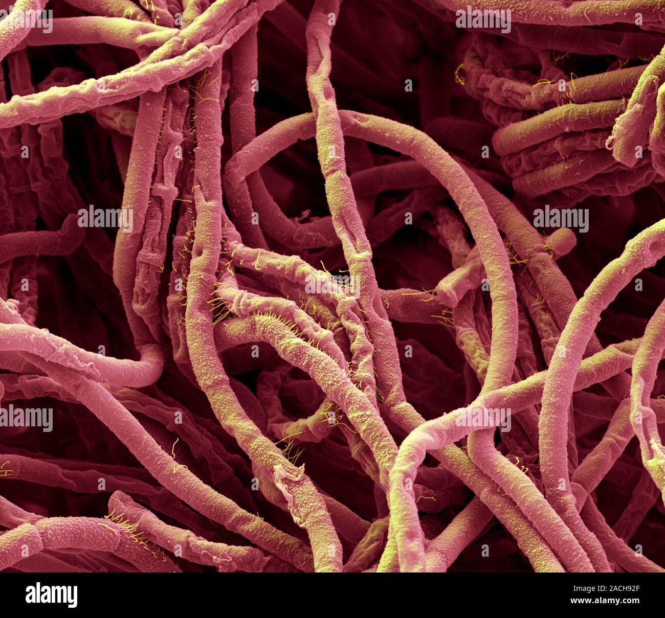 Anthrax bacteria. Coloured scanning electron micrograph (SEM) of ...