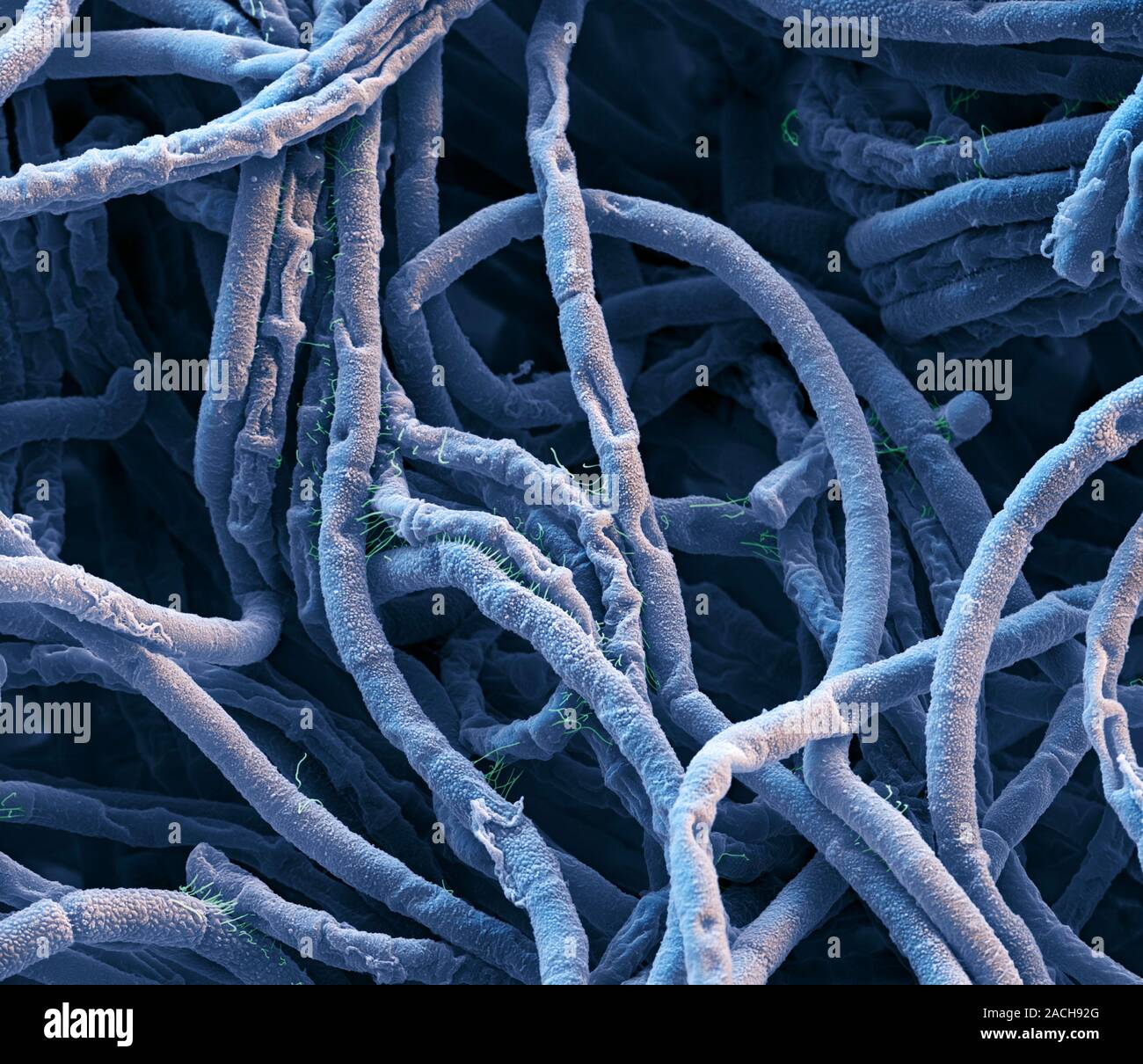 Anthrax bacteria. Coloured scanning electron micrograph (SEM) of ...