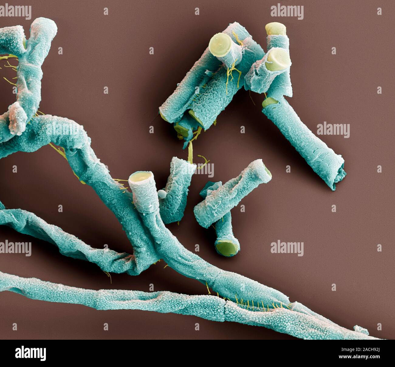 Anthrax bacteria. Coloured scanning electron micrograph (SEM) of ...