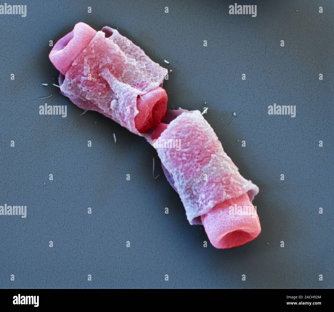 Anthrax spores. Coloured scanning electron micrograph (SEM) of Bacillus ...