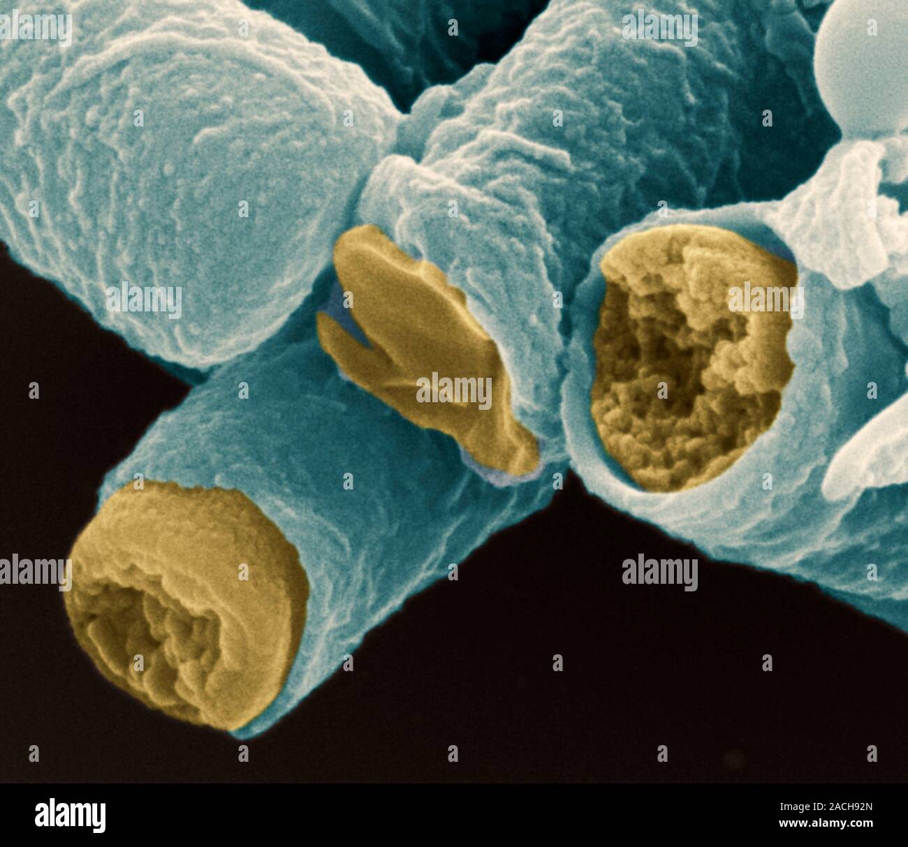 Anthrax spores. Coloured scanning electron micrograph (SEM) of Bacillus ...