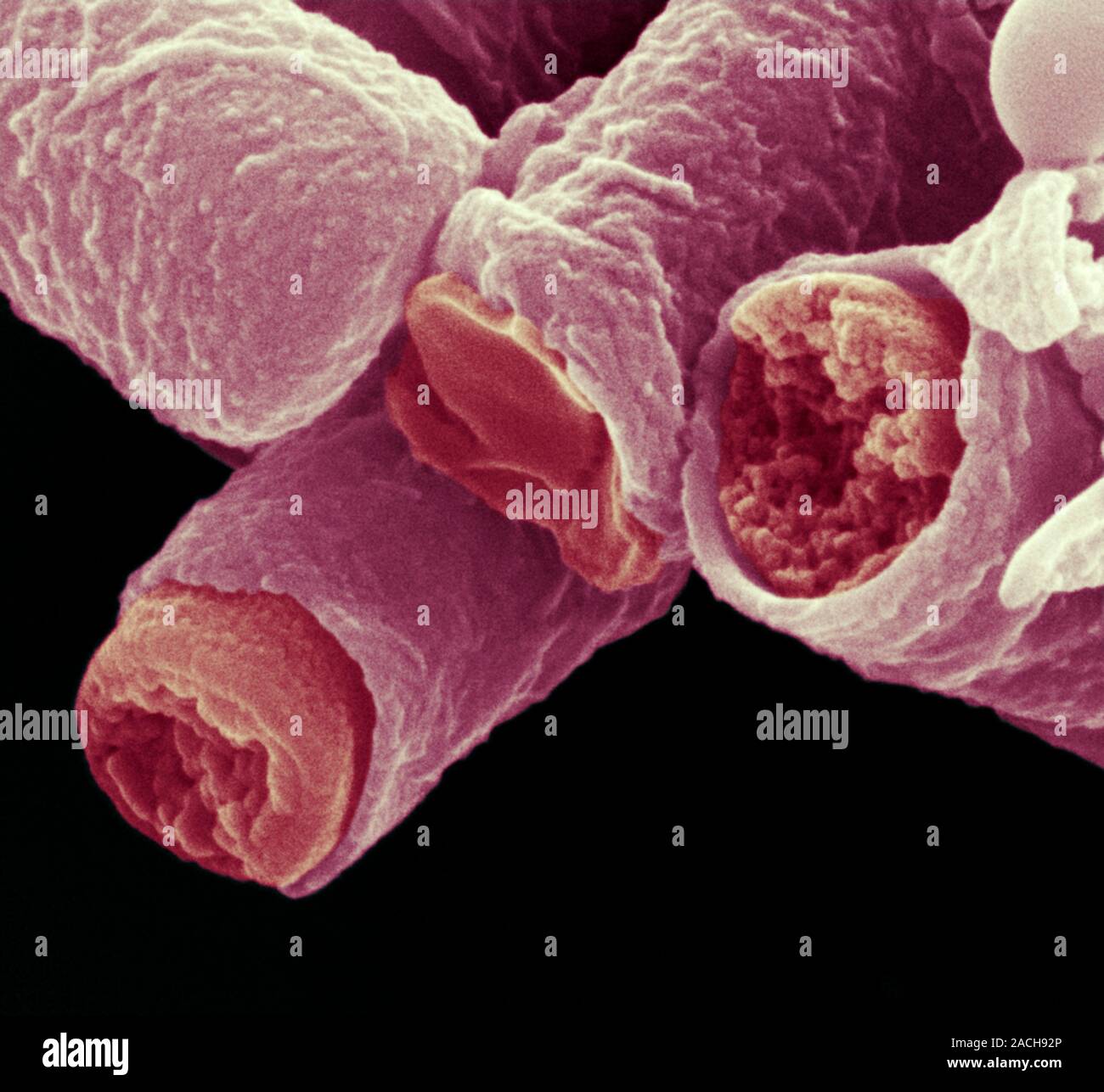 Anthrax spores. Coloured scanning electron micrograph (SEM) of Bacillus ...