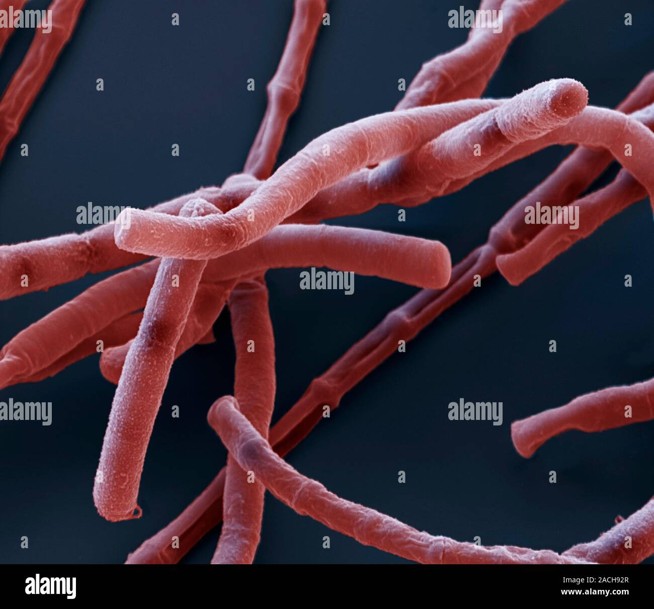Anthrax Bacteria Coloured Scanning Electron Micrograph Sem Of