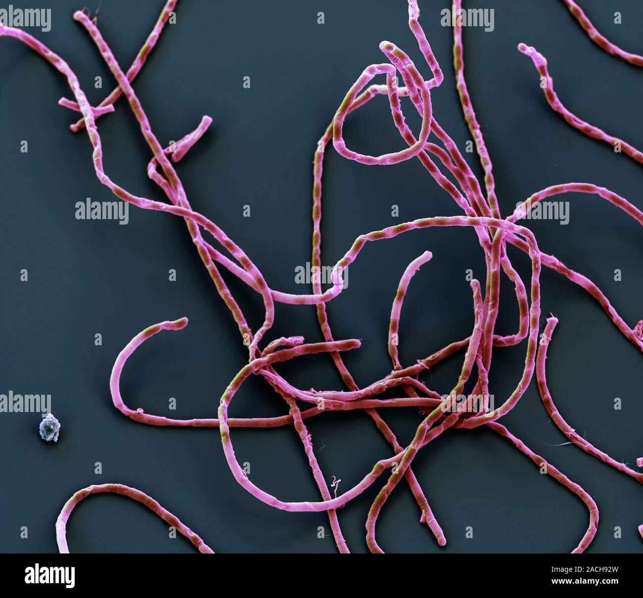 Anthrax bacteria. Coloured scanning electron micrograph (SEM) of ...