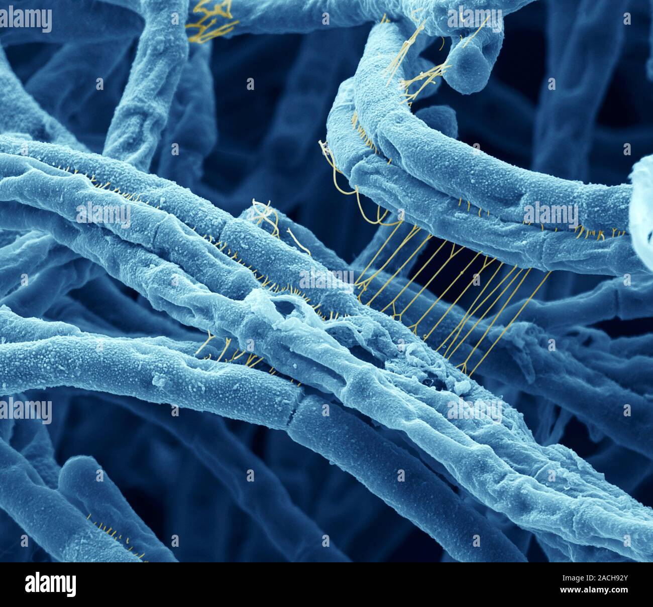 Anthrax bacteria. Coloured scanning electron micrograph (SEM) of ...
