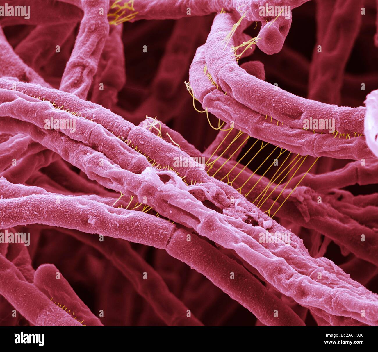 Anthrax bacteria. Coloured scanning electron micrograph (SEM) of ...