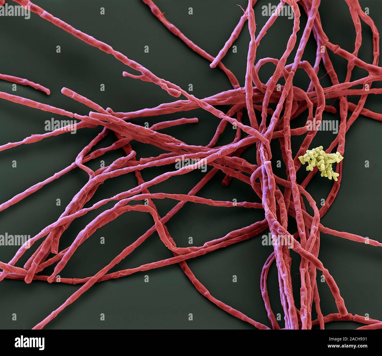 Anthrax bacteria. Coloured scanning electron micrograph (SEM) of ...