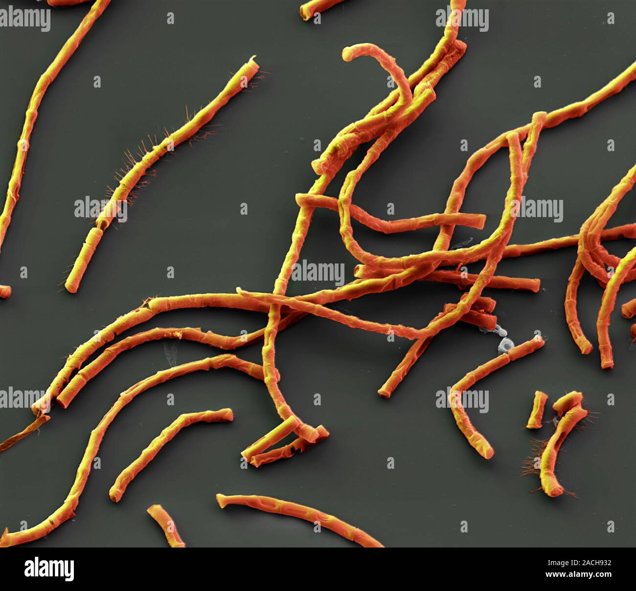 Anthrax bacteria. Coloured scanning electron micrograph (SEM) of ... Anthrax bacteria. Coloured scanning electron micrograph (SEM) of ...