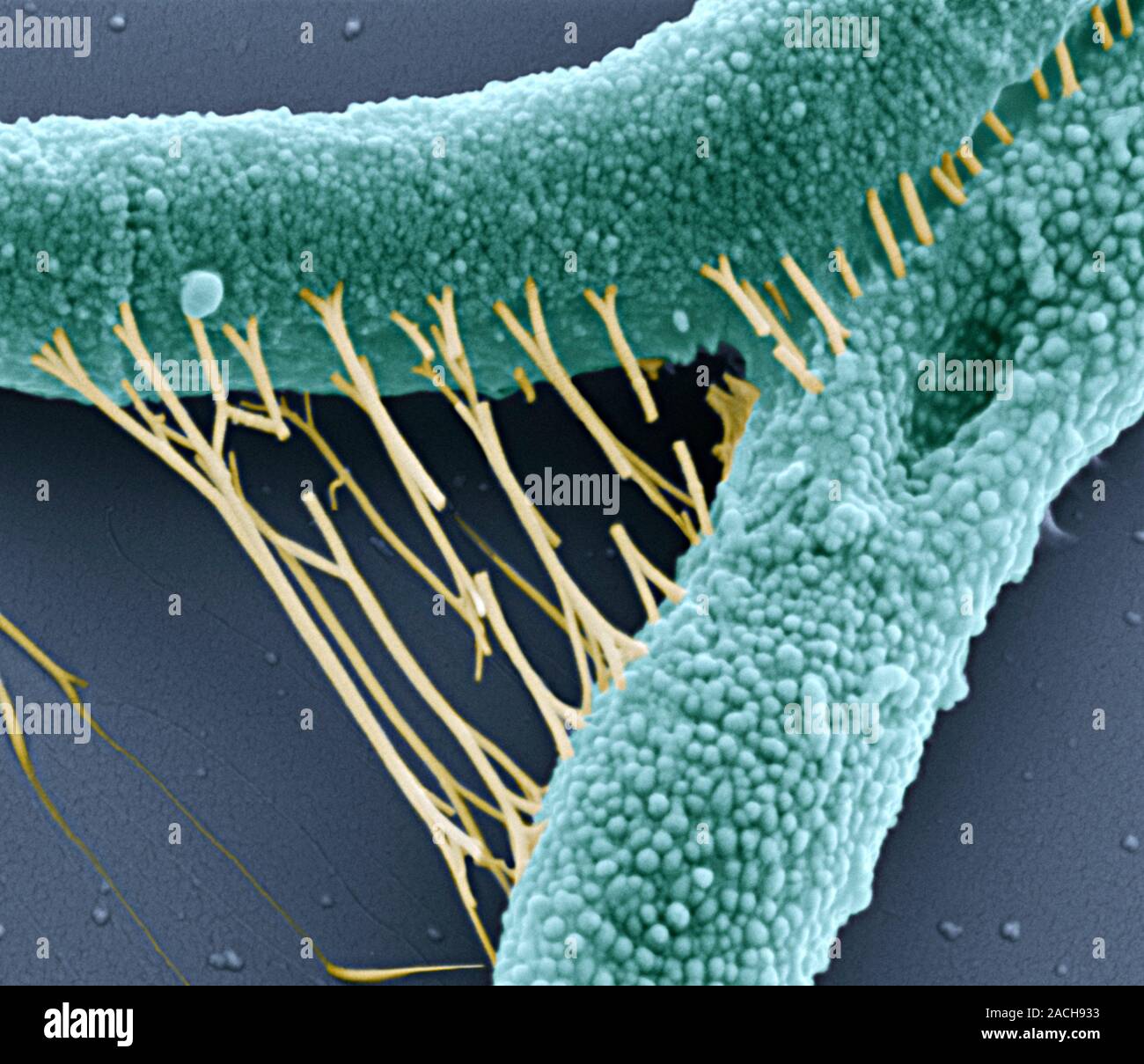 Anthrax Bacteria Coloured Scanning Electron Micrograph Sem Of