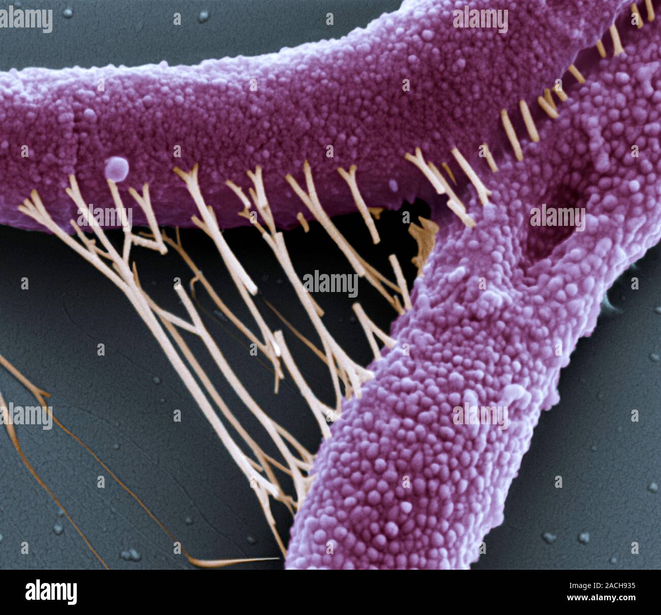 Anthrax bacteria. Coloured scanning electron micrograph (SEM) of ...