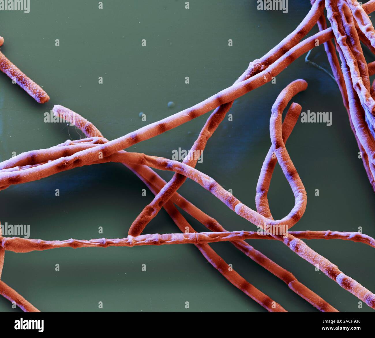 Anthrax bacteria. Coloured scanning electron micrograph (SEM) of ...