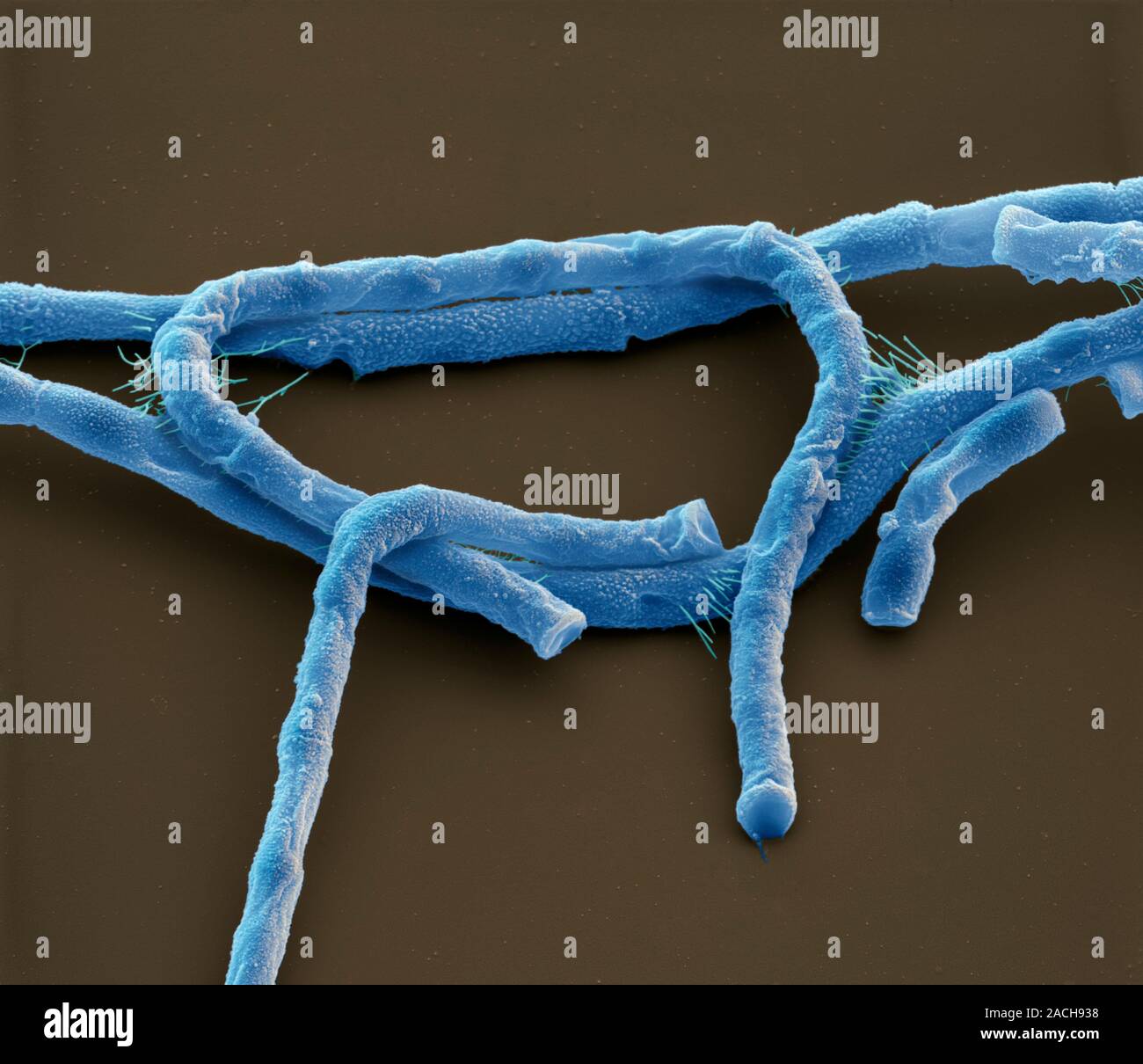 Anthrax bacteria. Coloured scanning electron micrograph (SEM) of ...