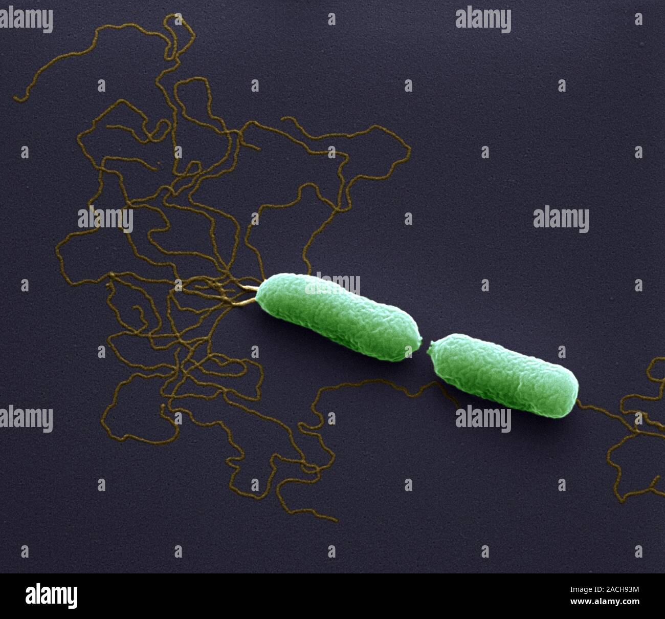 Burkholderia pseudomallei bacteria, coloured scanning electron ...