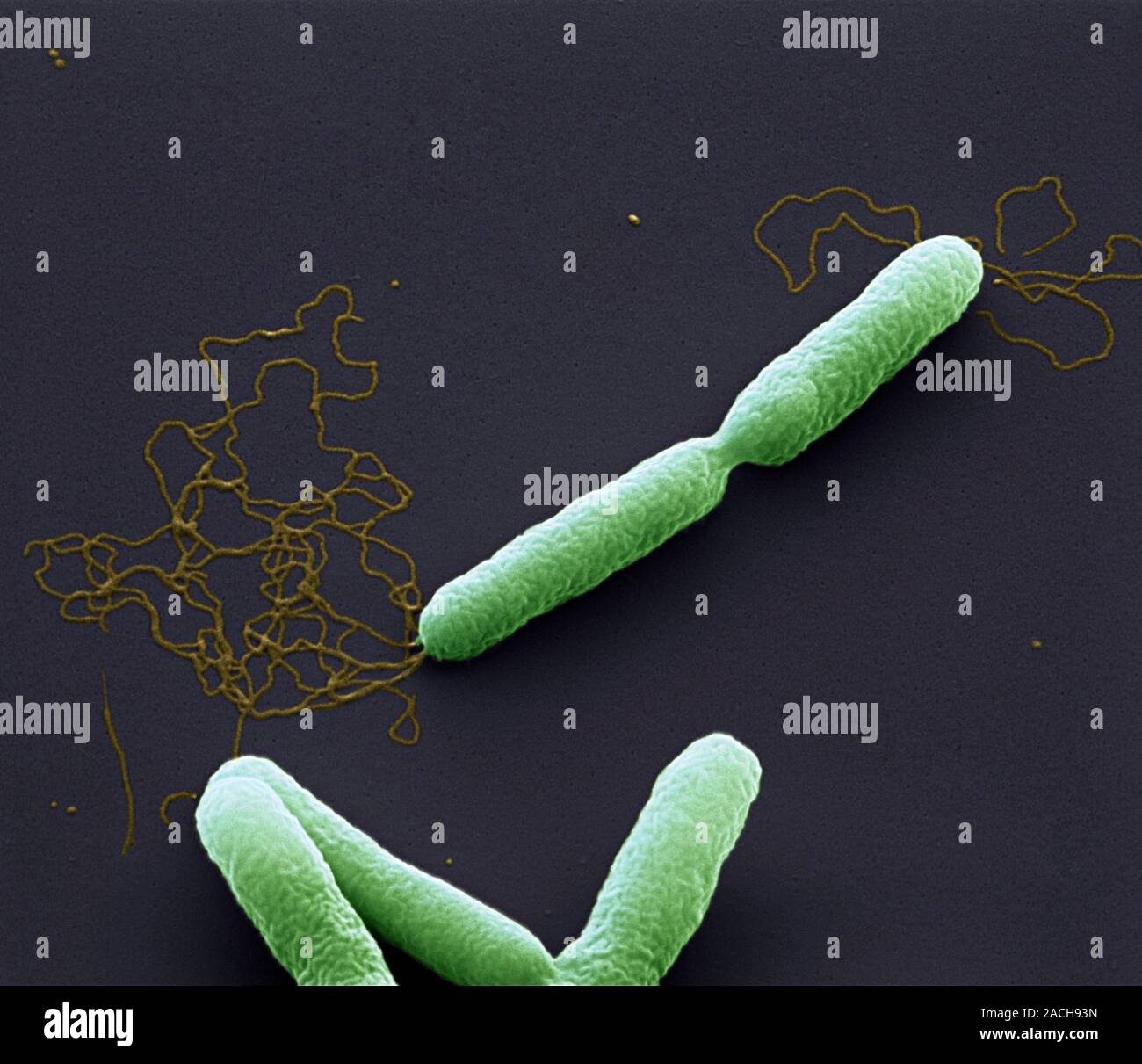 Burkholderia pseudomallei bacteria, coloured scanning electron ...