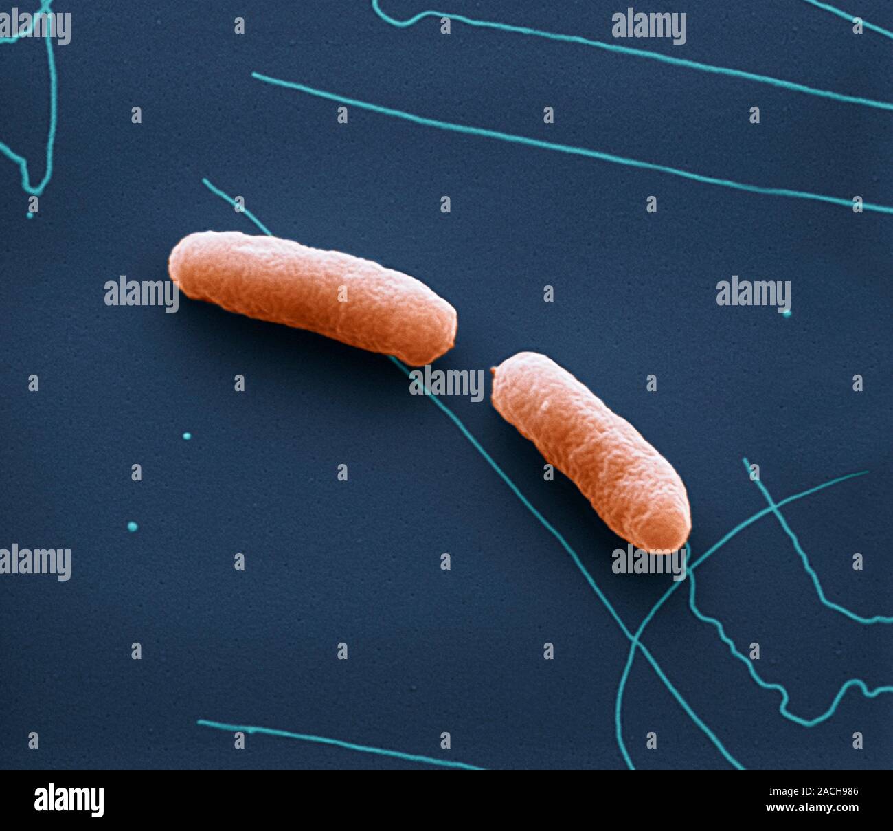 Burkholderia pseudomallei bacteria, coloured scanning electron ...