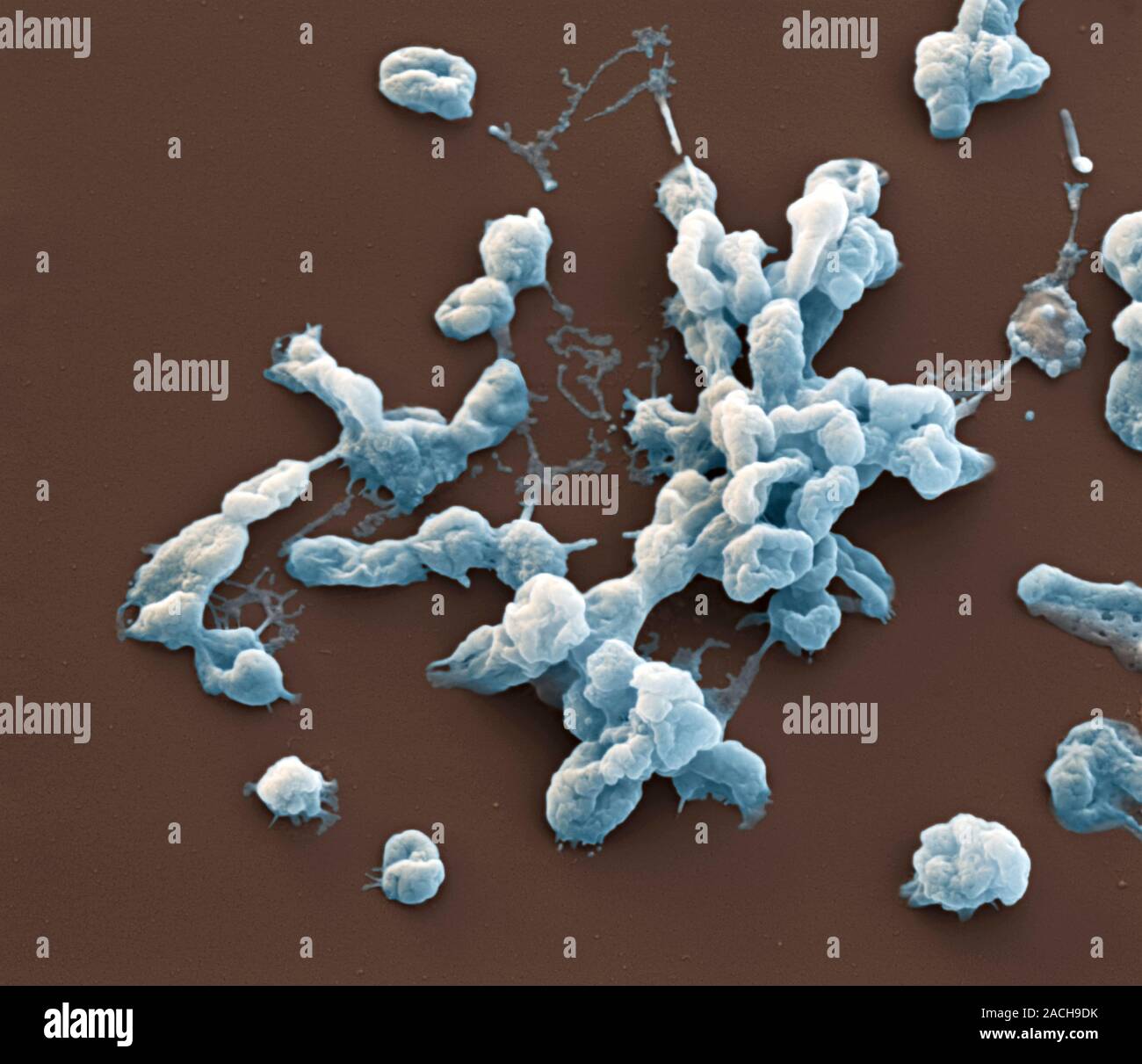 Francisella tularensis bacteria, coloured scanning electron micrograph ...