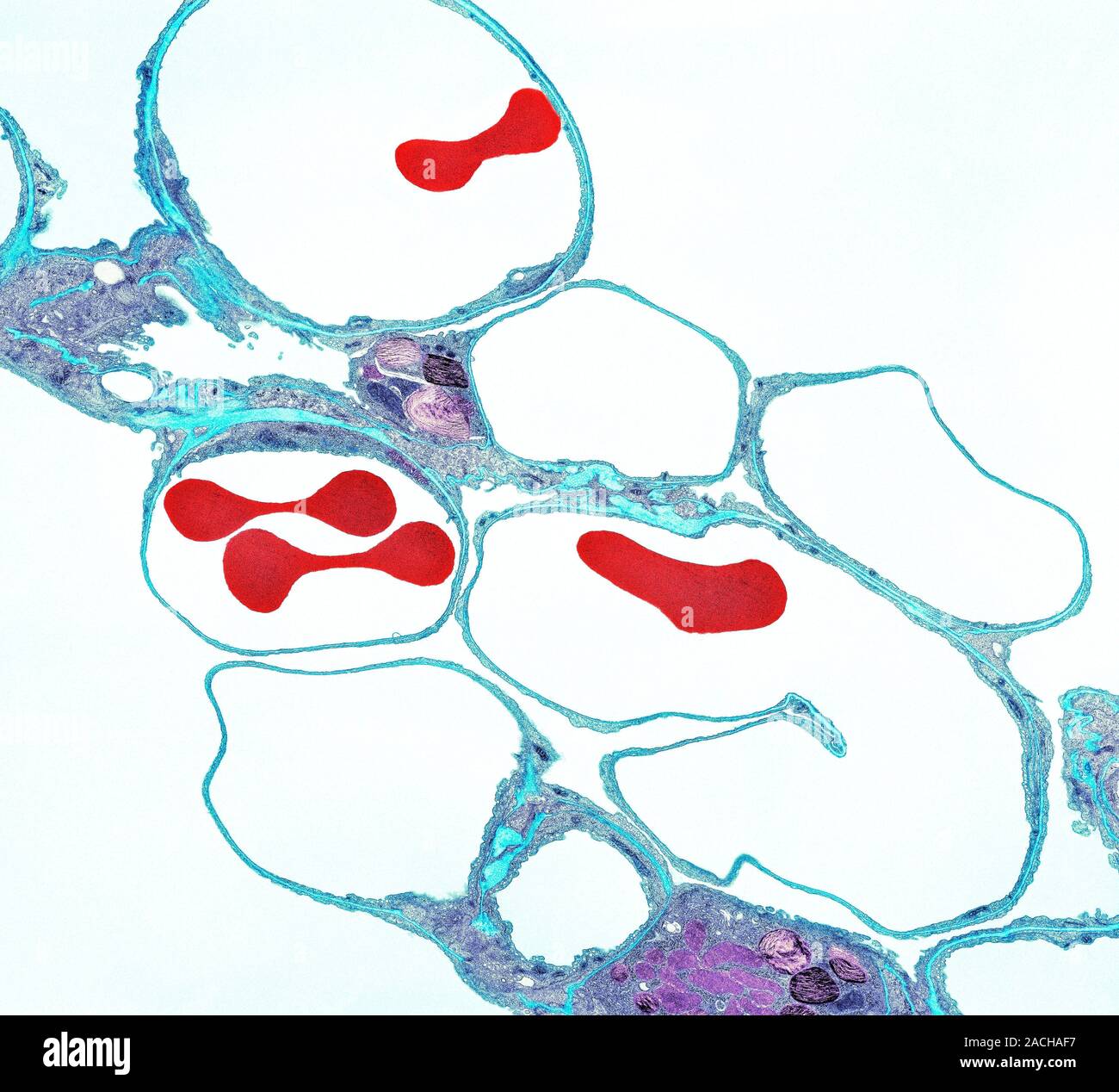Lung alveoli and red blood cells. Coloured transmission electron ...