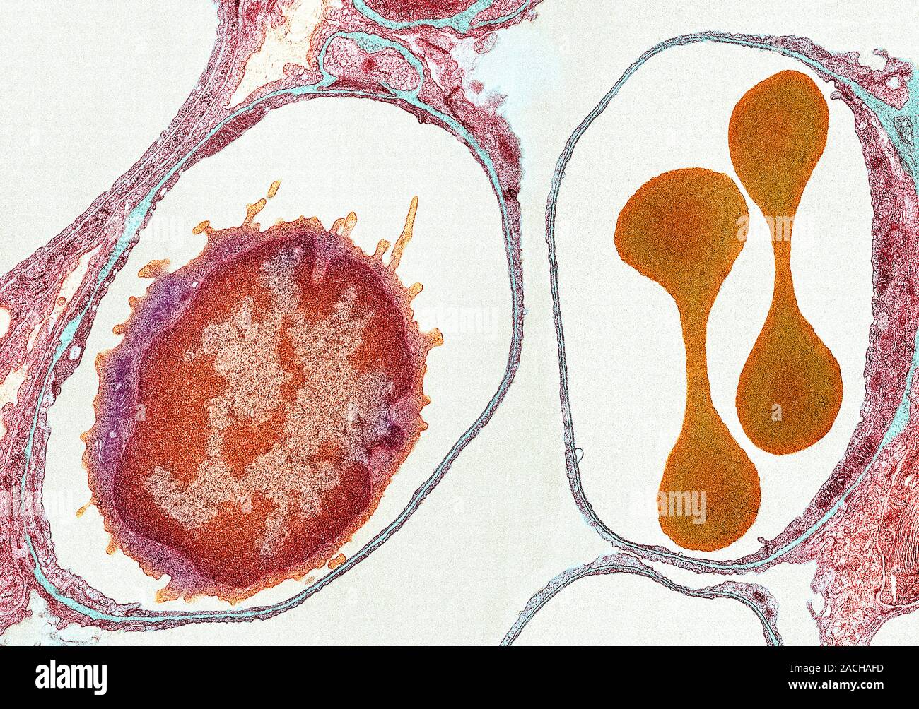 Lung alveoli and blood cells. Coloured transmission electron micrograph ...