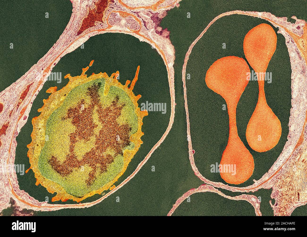 Lung alveoli and blood cells. Coloured transmission electron micrograph ...