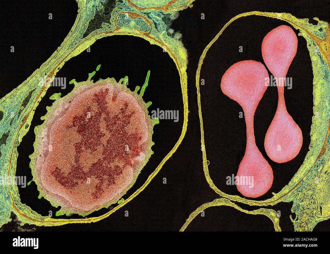 Lung alveoli and blood cells. Coloured transmission electron micrograph ...