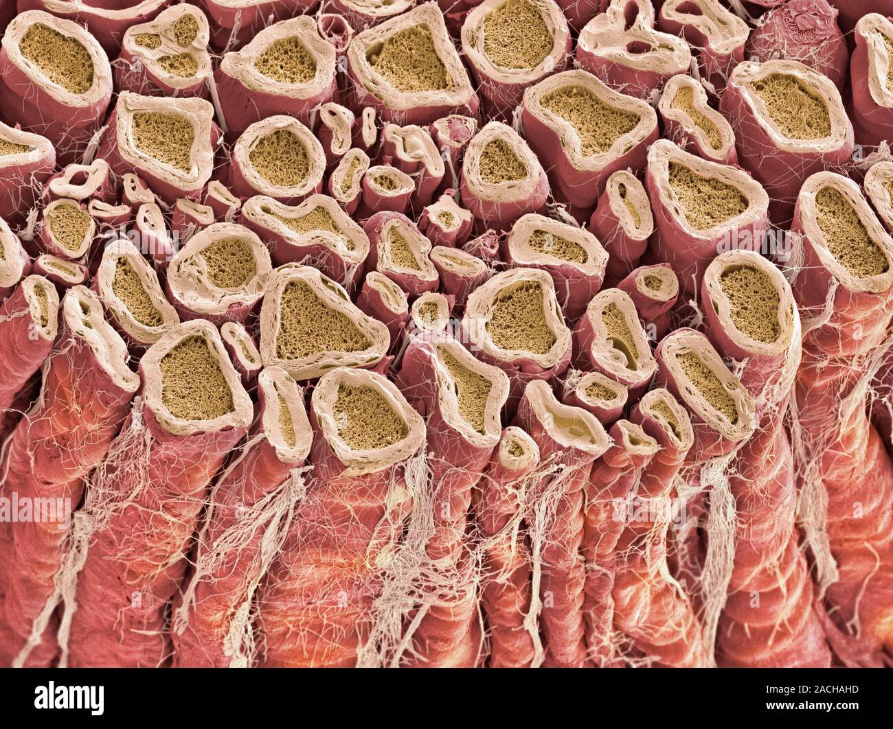Spinal root nerves. Coloured scanning electron micrograph (SEM) of a ...