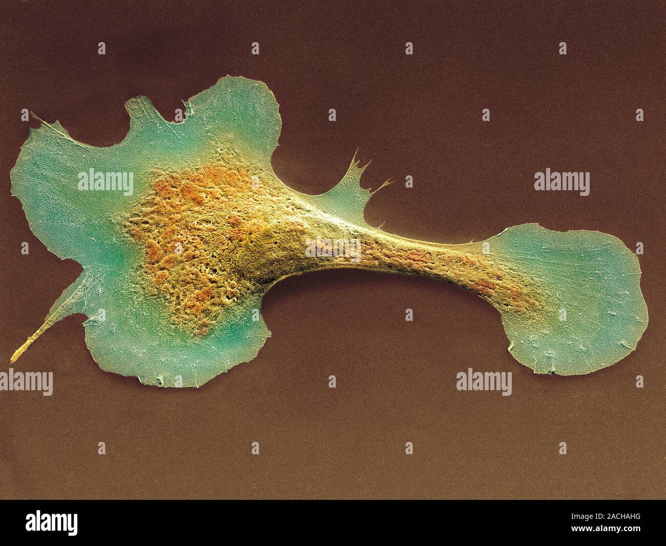 Heart muscle cell. Coloured scanning electron micrograph (SEM) of a ...