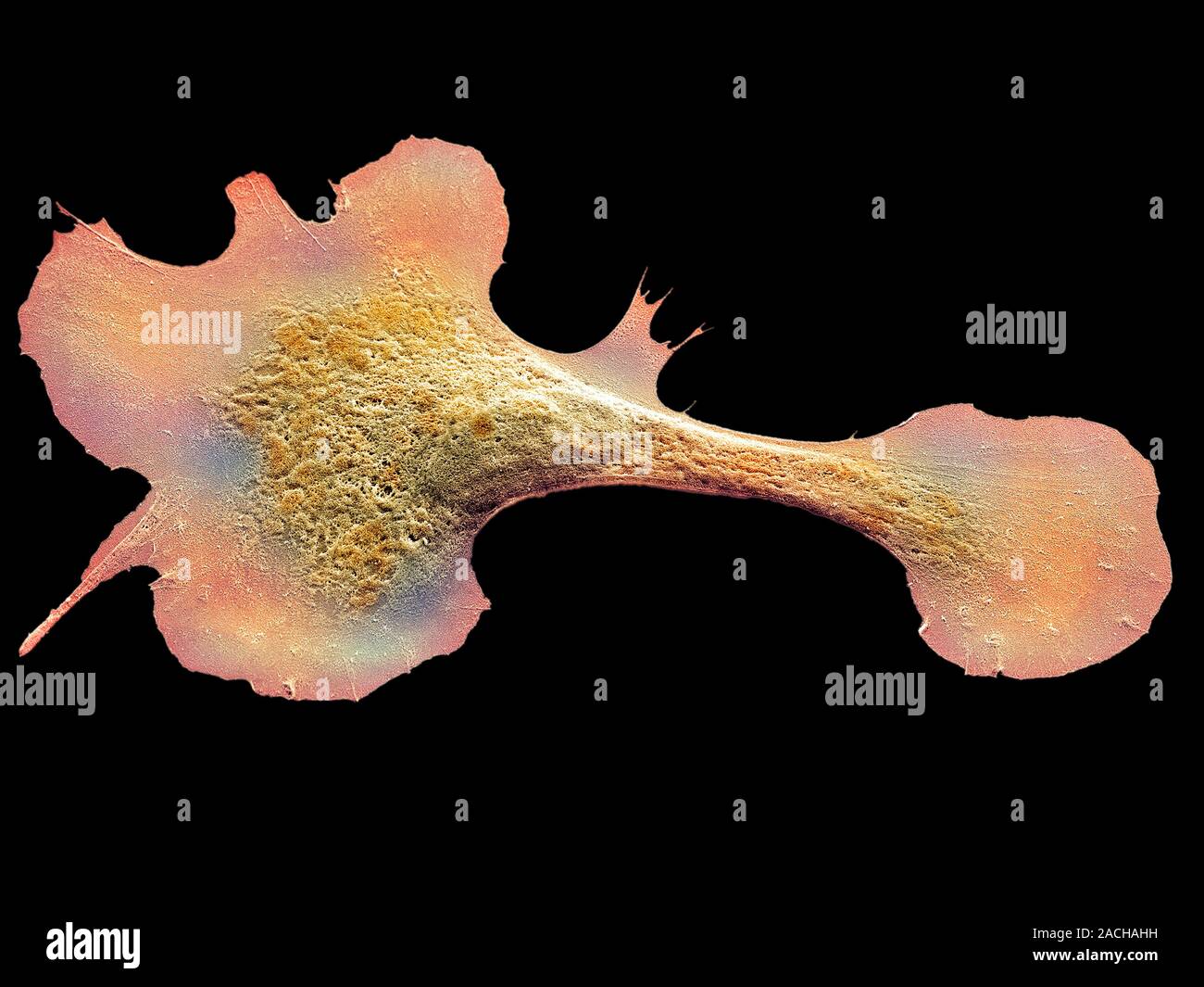 Heart muscle cell. Coloured scanning electron micrograph (SEM) of a ...