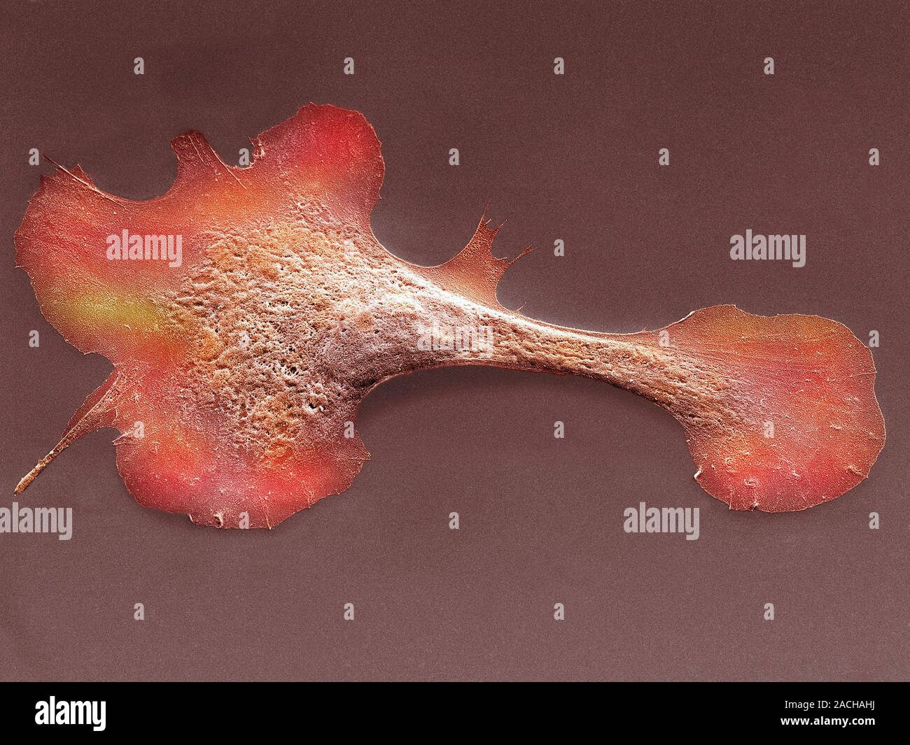 Heart muscle cell. Coloured scanning electron micrograph (SEM) of a ...