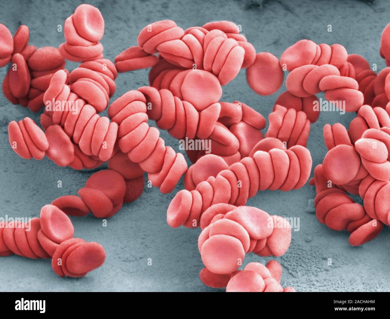 Stacked red blood cells, coloured scanning electron micrograph (SEM ...