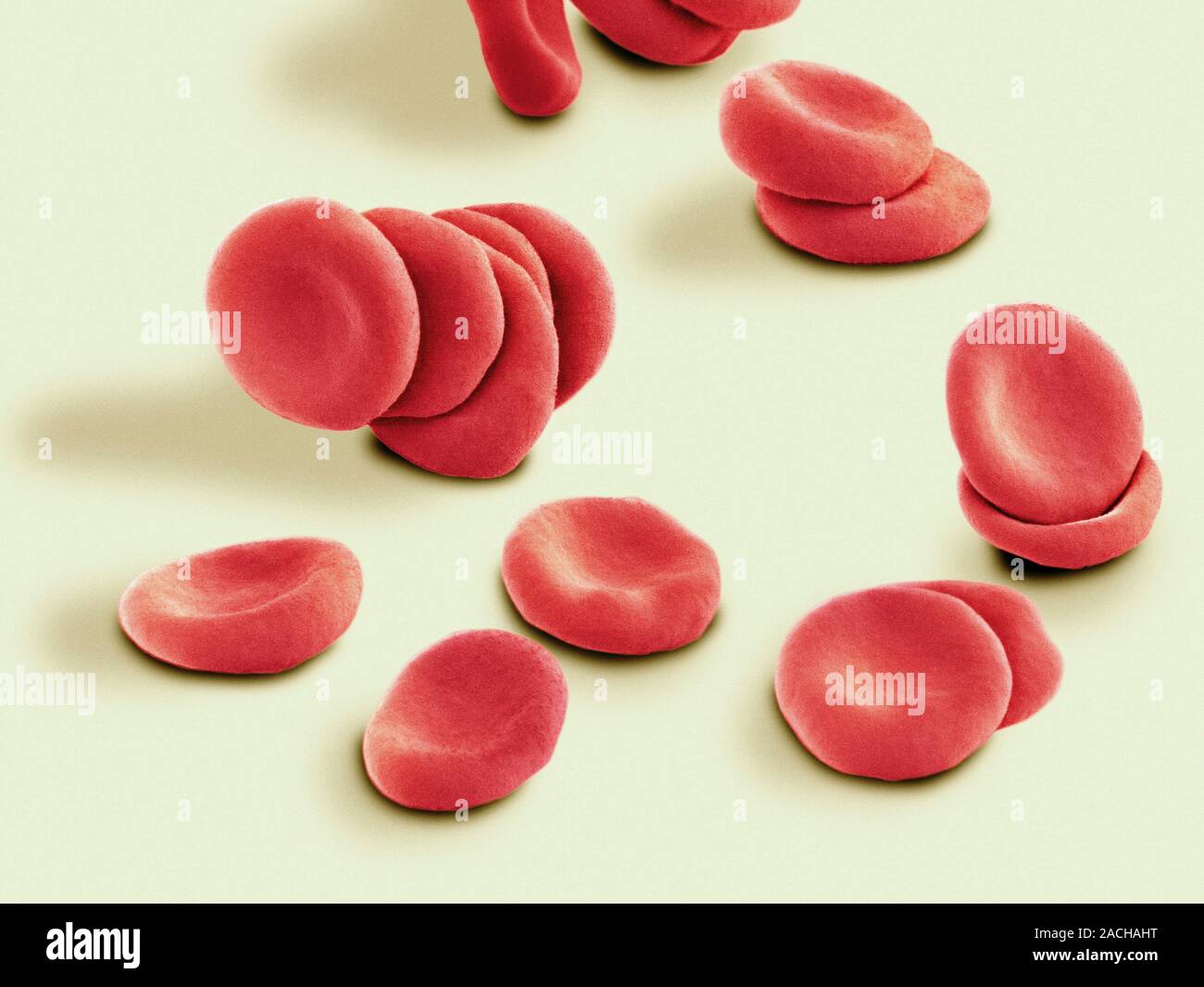 Stacked red blood cells, coloured scanning electron micrograph (SEM ...