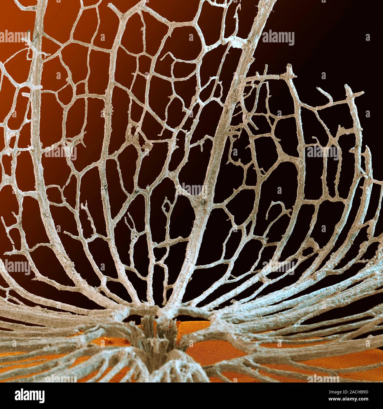 Cape gooseberry. Coloured scanning electron micrograph (SEM) of the dry ...