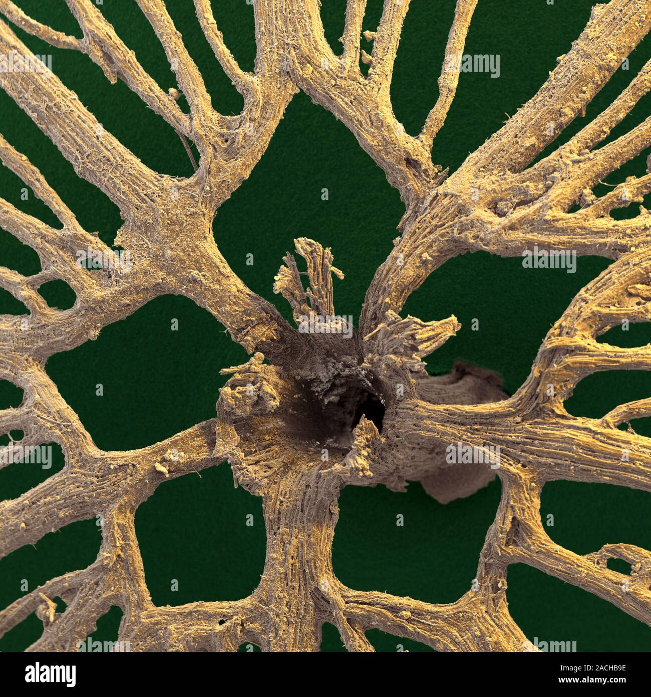 Cape gooseberry. Coloured scanning electron micrograph (SEM) of the dry ...