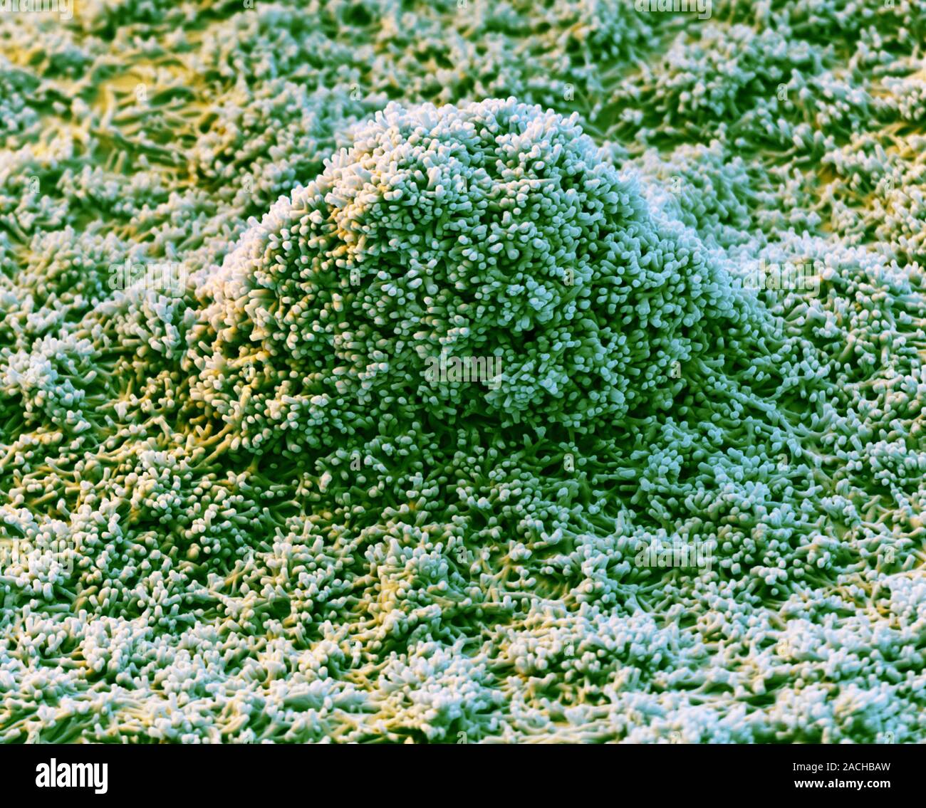 Lotus leaf surface. Coloured scanning electron micrograph (SEM) showing ...