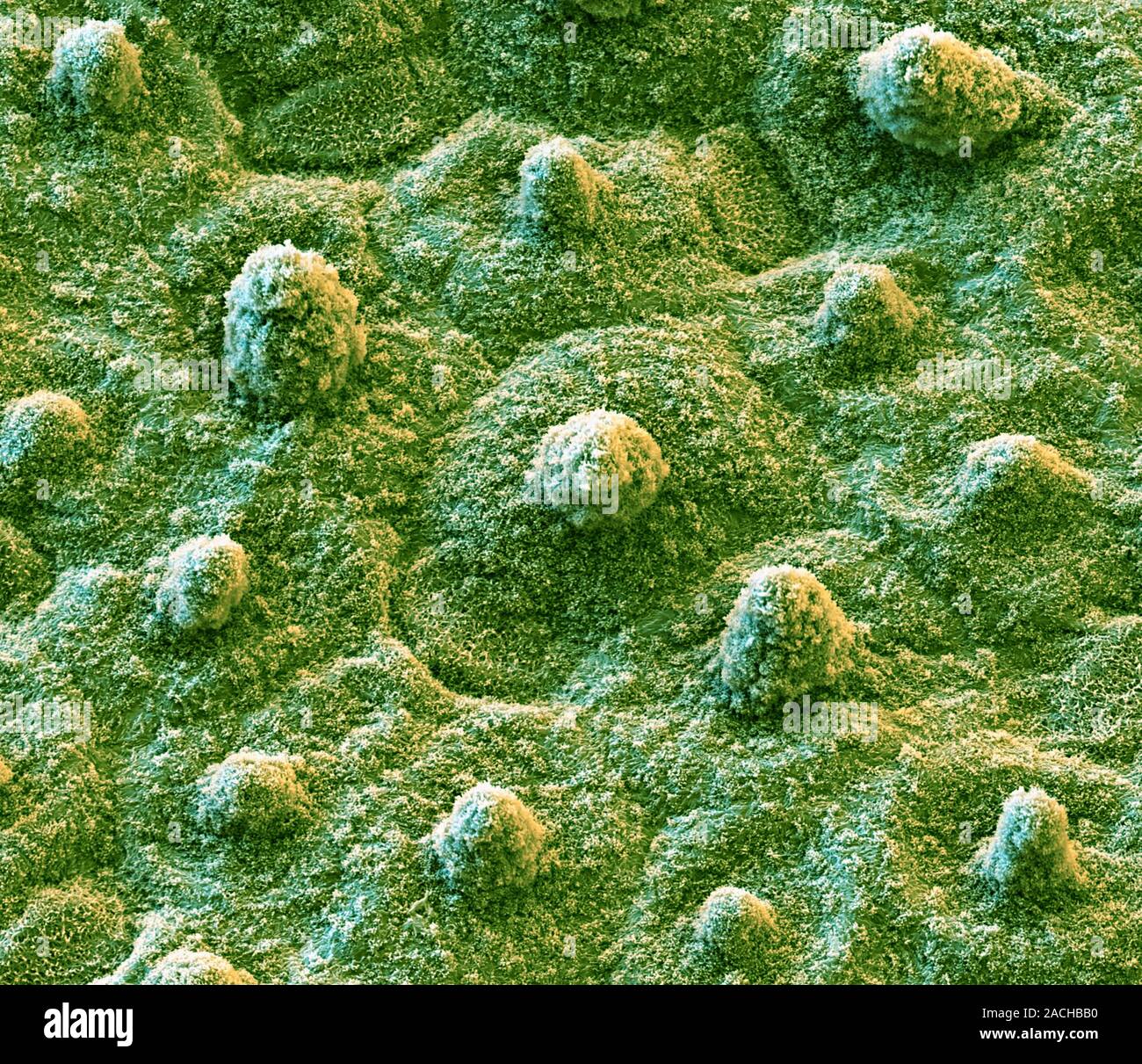 Lotus leaf surface. Coloured scanning electron micrograph (SEM) showing the microstructures on ...