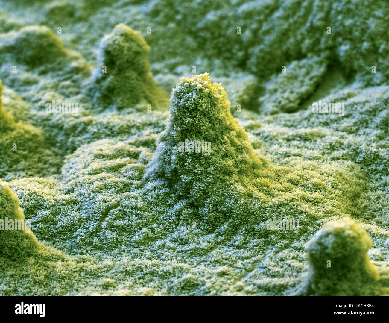 Lotus leaf surface. Coloured scanning electron micrograph (SEM) showing ...