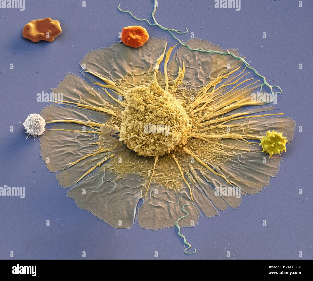 Human blood cells. Coloured scanning electron micrograph (SEM) of a ...