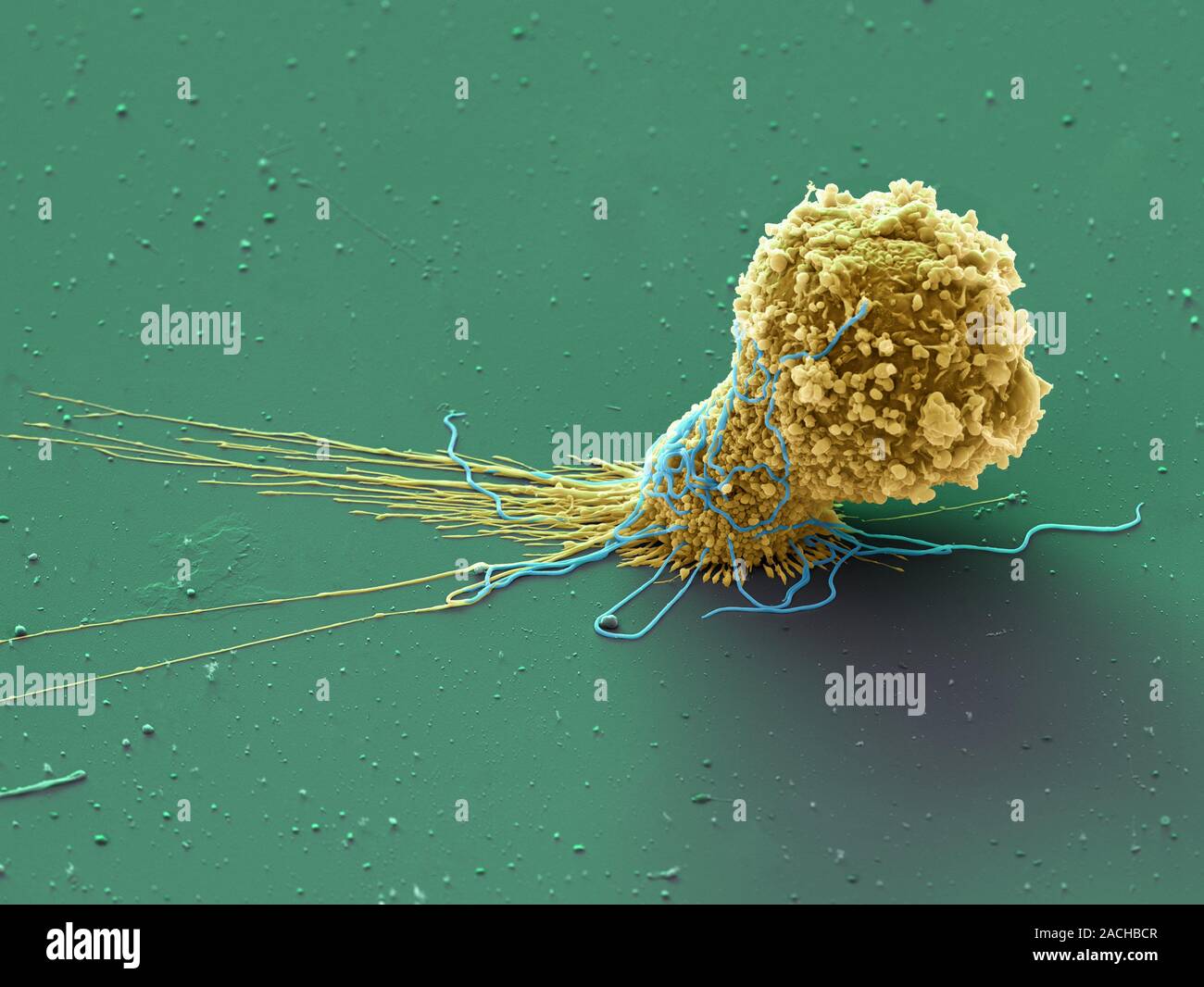 Macrophage engulfing bacteria. Coloured scanning electron micrograph ... Macrophage engulfing bacteria. Coloured scanning electron micrograph ...