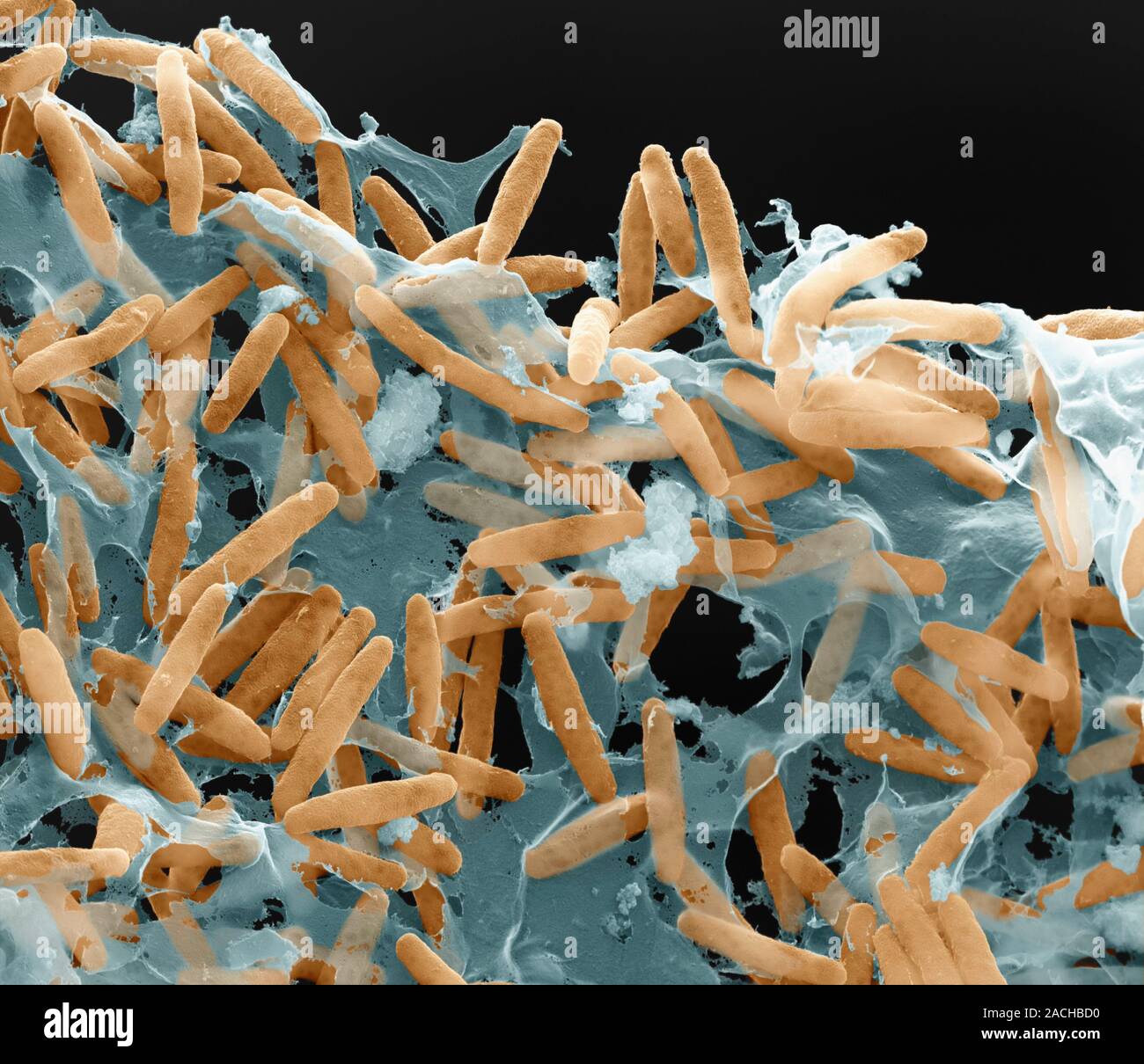Myxococcus xanthus bacteria, coloured scanning electron micrograph (SEM ...