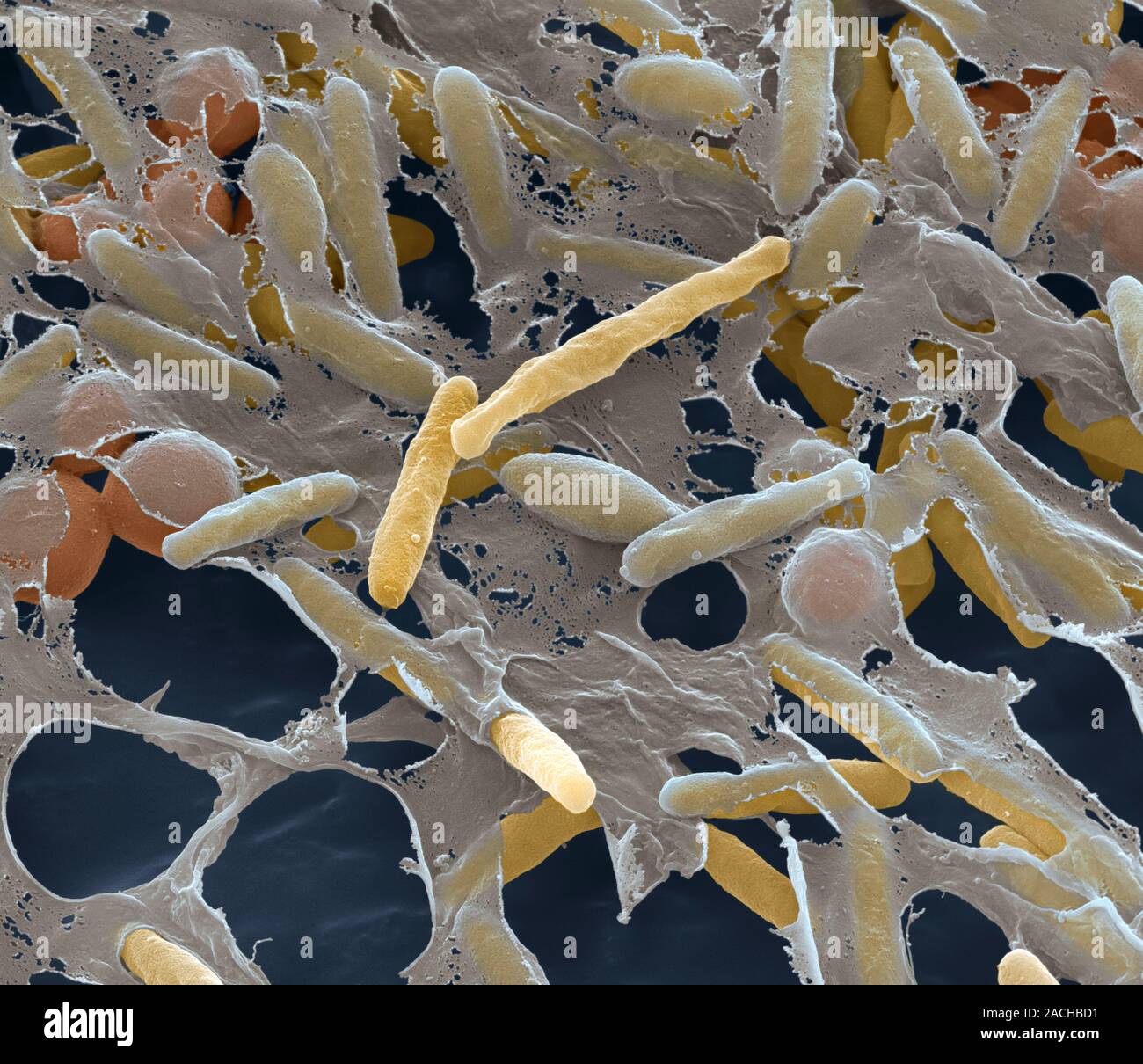 Myxococcus xanthus bacteria, coloured scanning electron micrograph (SEM ...