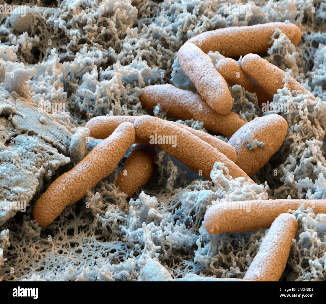 Myxococcus xanthus bacteria, coloured scanning electron micrograph (SEM ...