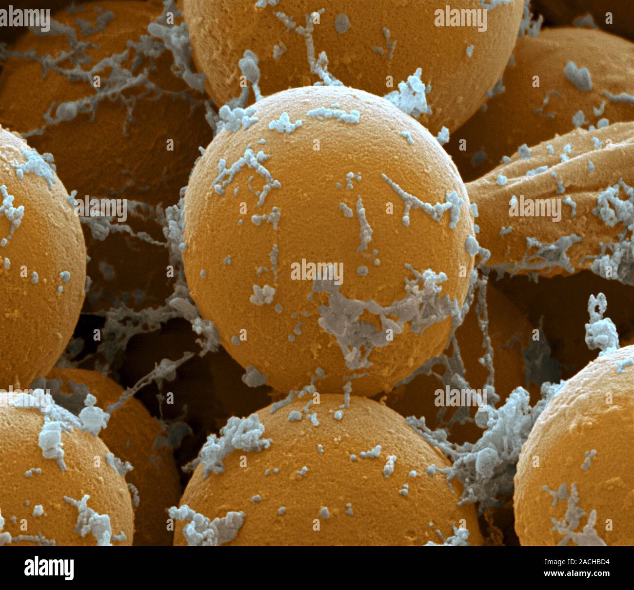 Myxococcus xanthus bacteria spores (round), coloured scanning electron ...