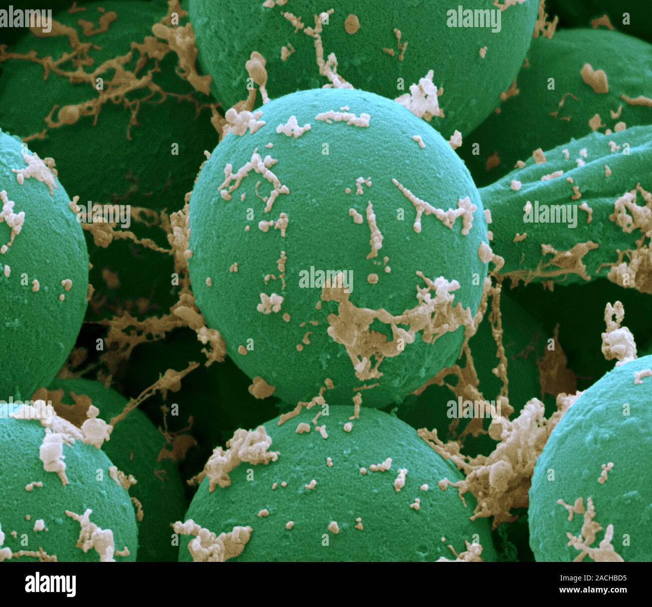 Myxococcus xanthus bacteria spores (round), coloured scanning electron ...