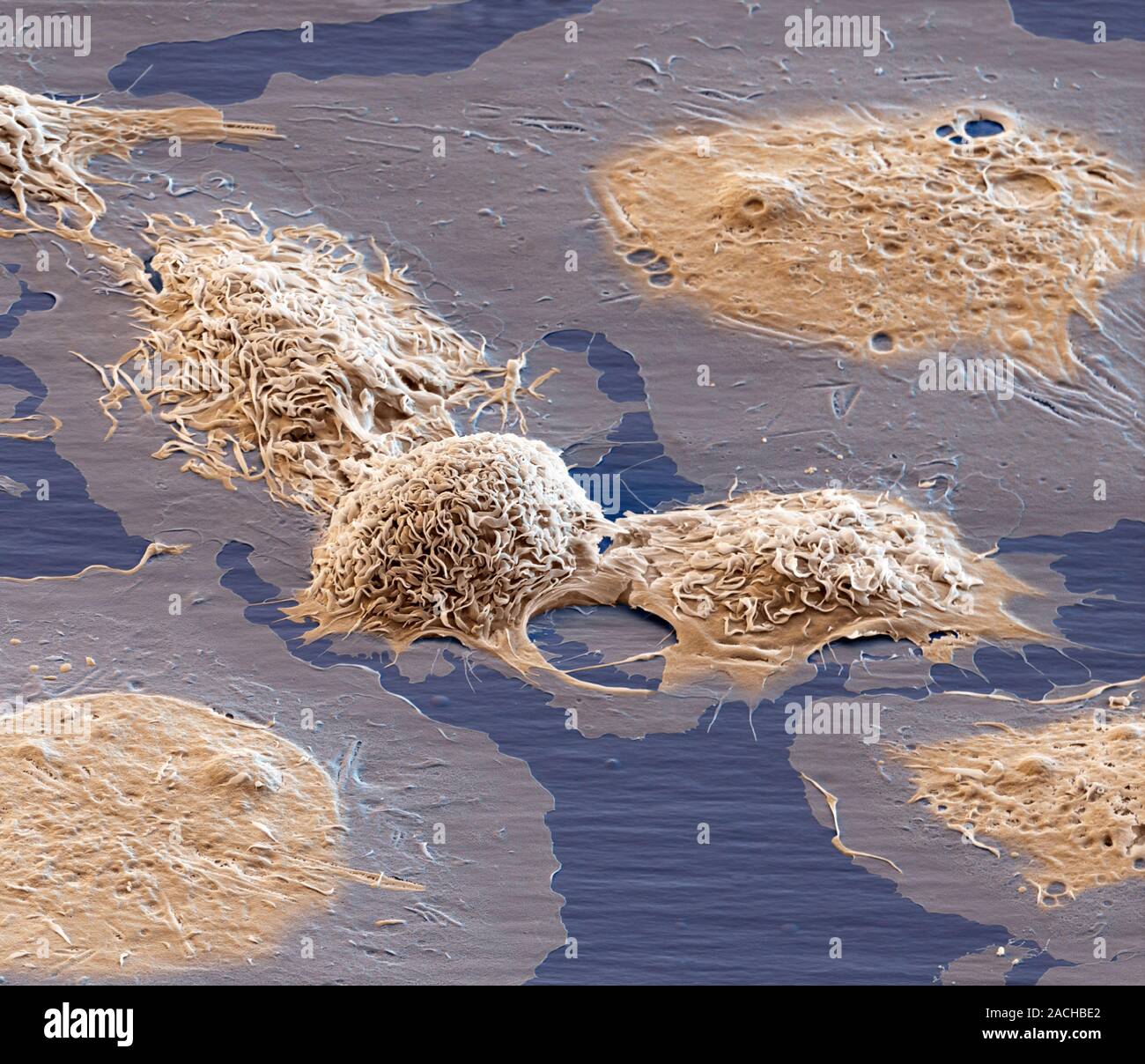 THP-1 cells. Coloured scanning electron micrograph (SEM) of cultured ...