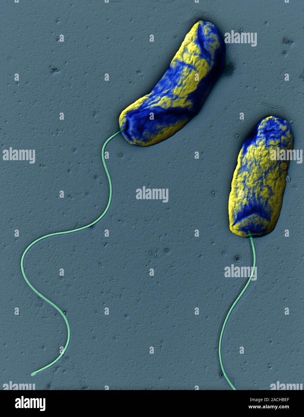 Cholera bacteria. Coloured transmission electron micrograph (TEM) of ...