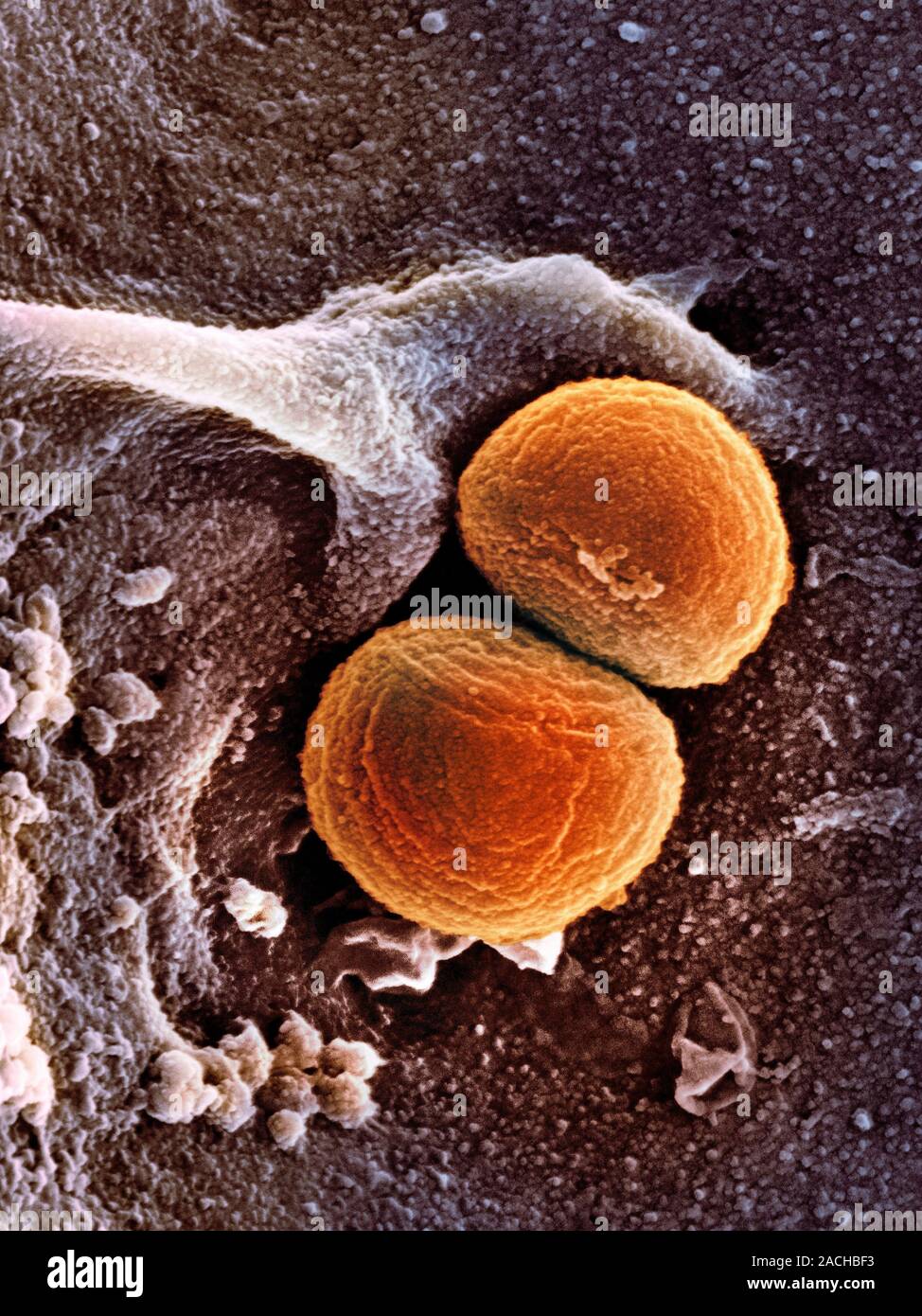 Staphylococcus aureus bacteria. Coloured scanning electron micrograph ...