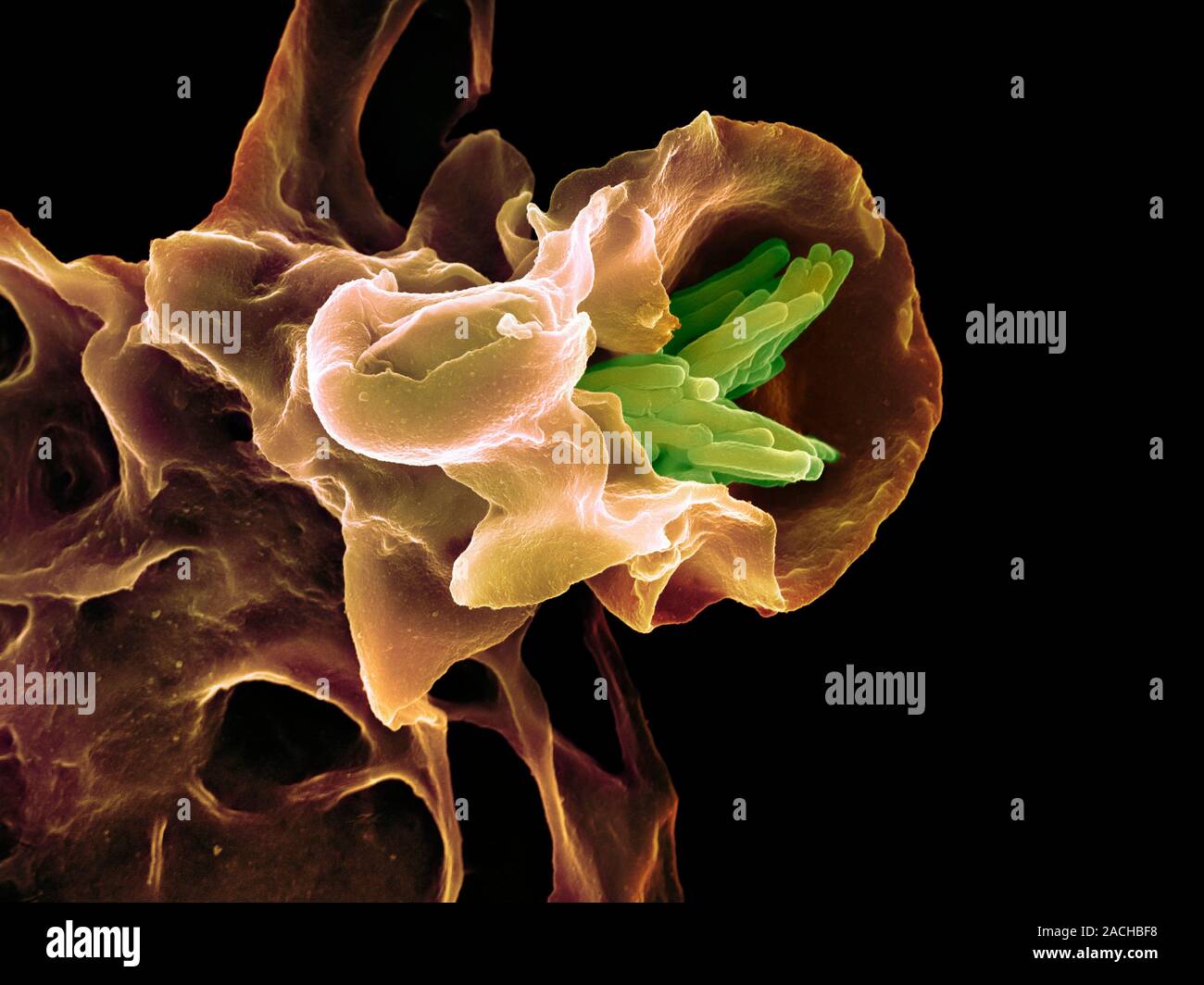 Macrophage engulfing TB bacteria. Coloured scanning electron micrograph (SEM) of a macrophage ...