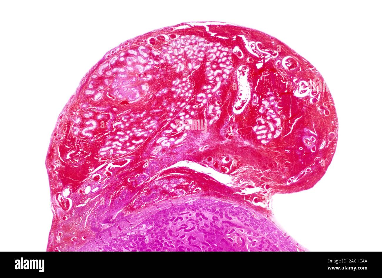 Torsion of the testis. Light micrograph of a section through a testis ...