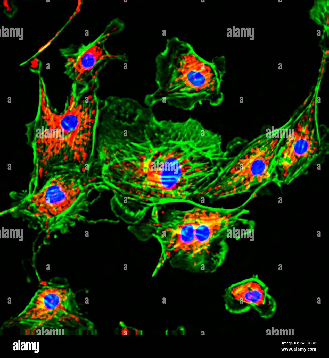 Pulmonary artery cells. Fluorescence deconvolution micrograph of ...